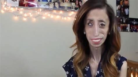 Lizzie Velasquez La Femme La Plus Laide Du Monde Lance Un Appel Pour