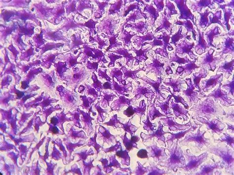 APExBIO Crystal Violet Staining Solution