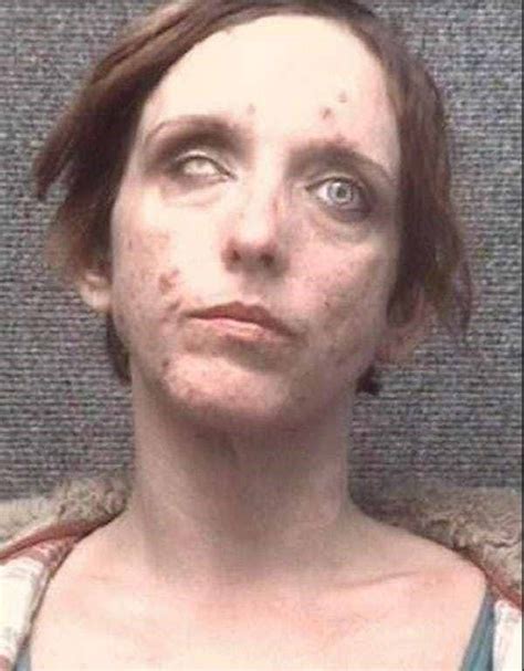A Woman With Freckles On Her Face Looking Up