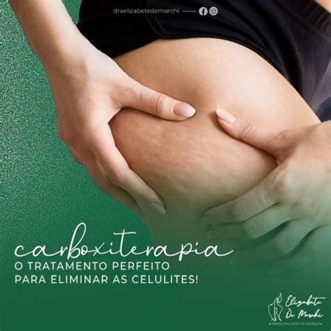 Tratamentos estéticos para sua celulite Clínica de Estética Elizabete