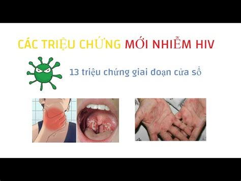 Triệu Chứng Nhiễm HIV Giai Đoạn Cửa Sổ Nhận Biết Sớm Để Phòng Ngừa