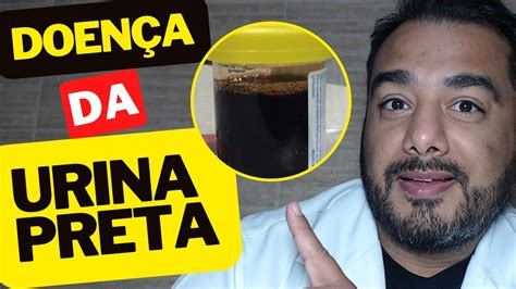 Doença da Urina Preta ou Síndrome de Haff sintomas causas toxina