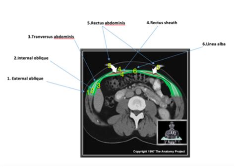 Abdominal Hernia Anatomy