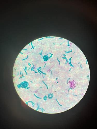 Bio 2 Lab Exam 1 Protists Flashcards Quizlet