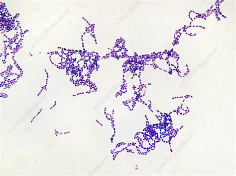 Streptococcus Pyogenes Bacteria Stock Image B236 0157 Science