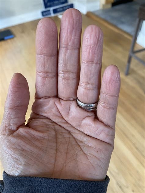 Daria Oller Pt Dpt Atc On Twitter My Fingers Still Look Like