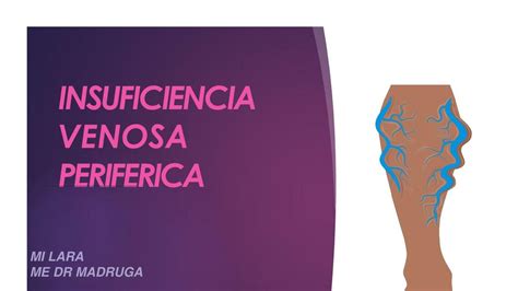 INSUFICIENCIA VENOSA PERIFERICA Erika Puerto UDocz