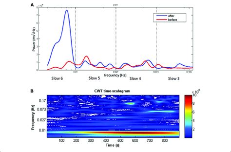 a continuous wavelet transform cwt reaction time rt spectrogram download scientific