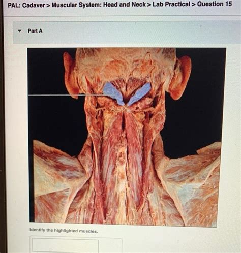 Solved M Labqulz Pal Cadaver Muscular System Head And Chegg