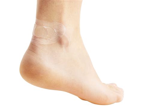 Cómo evitar ampollas en los pies España