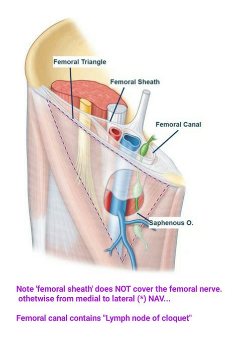 Femoral Sheath Canal Correction From Lateral To Medial