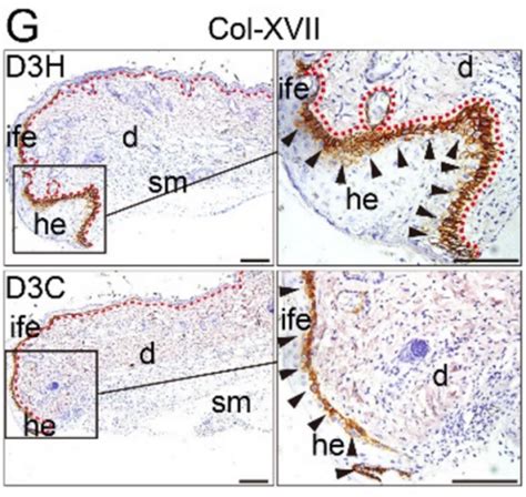 Ihc