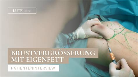 Brustvergr Erung Mit Eigenfett Patienteninterview Vor Der Operation