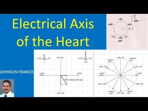 Electrical Axis Of The Heart YouTube
