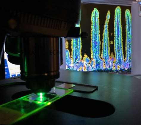 Fluorescence Microscopy Molecular Microbiology Imaging Facility