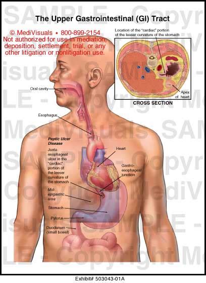 Upper Gastrointestinal Gi Tract Medical Exhibit