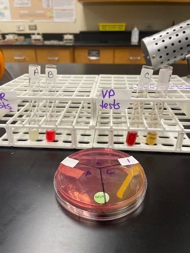 Microbiology Lab Final Flashcards Quizlet