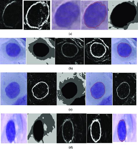 steps of the proposed neutrosophic graph cut based segmentation with download scientific
