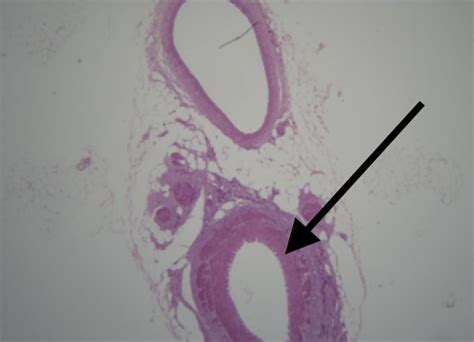Blood Vessel Histology Flashcards Quizlet