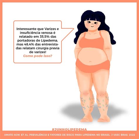 Lipedema sinais causas e diagnóstico 4 famosas que convivem
