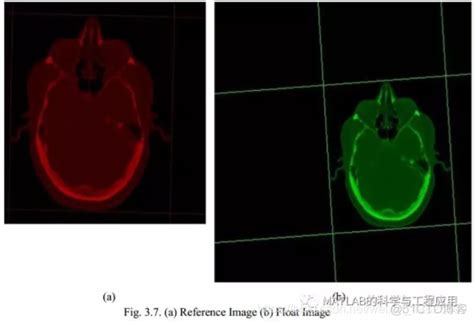 医学图像配准 python 医学图像配准技术 mob64ca13ff5b03的技术博客 51cto博客