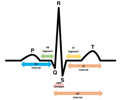 Bundle Branch Block Causes Symptoms Diagnosis Treatment