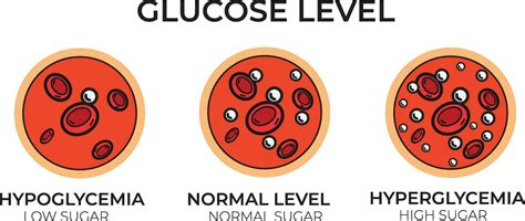 Glucose Blood Sugar Test Hypoglycemia Or Hyperglycemia Insulin