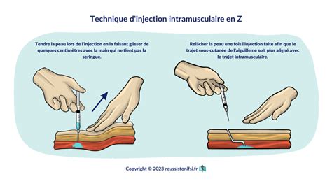 Fuite Sous Cutan E Apr S Injections Meso Rx Fran Ais