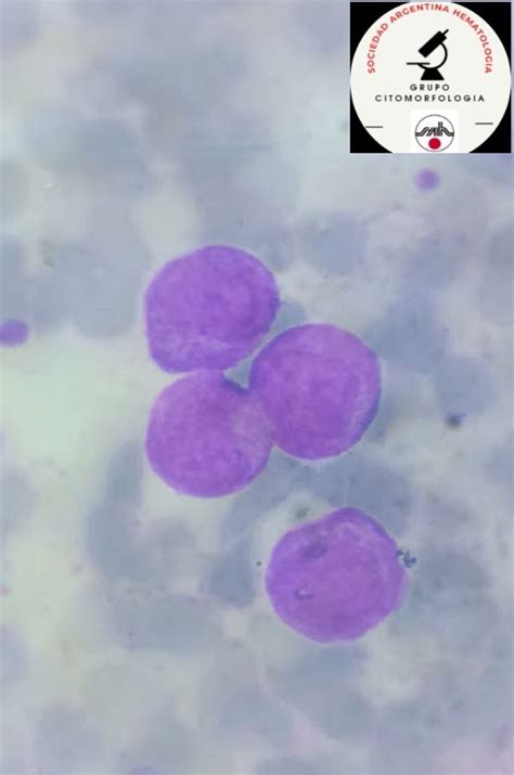 Sociedad Argentina De Hematolog A