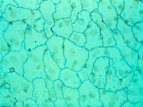 Identifying Tissue Types Epithelial Flashcards Quizlet