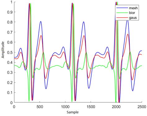 reconstructed ecg signal using wavelet thresholding method over download scientific diagram