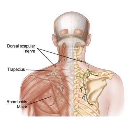What Is Dorsal Scapular Nerve Entrapment And How To Fix 44 OFF