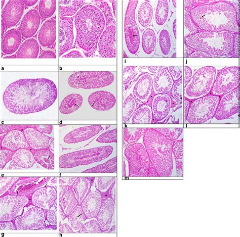 A Shows Normal Histological Structures Of Seminiferous Tubules In