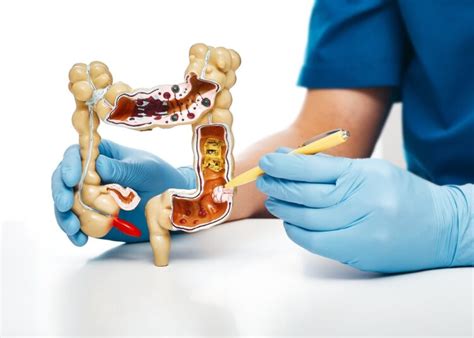 La transplantation de microbiote fécal augmente la survie dans le