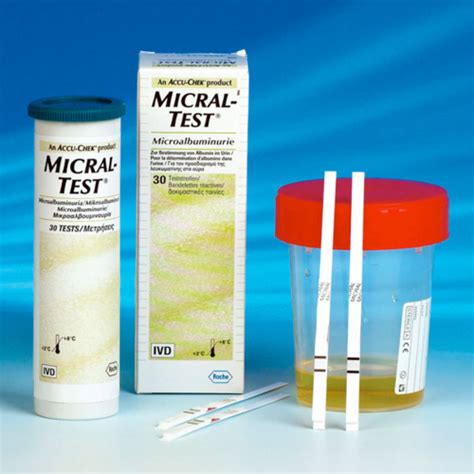 PART 2 Chemical Examination Of Urine Analysis Of Urine And Other