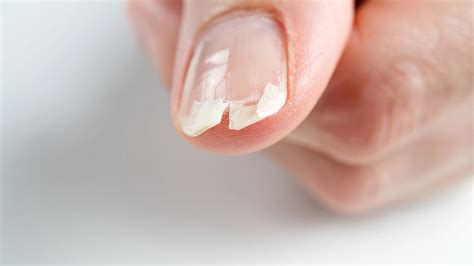 5 truques imparáveis para fortalecer unhas macias e frágeis