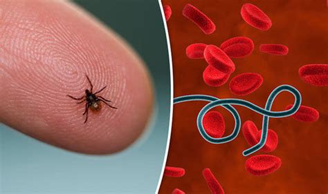 Borelioza Objawy Przyczyny Leczenie Diagnostyka Boreliozy