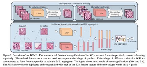 Dual Stream Multiple Instance Learning Network Dual Stream