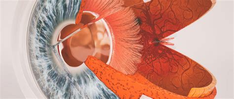 Was Ist Der Blinde Fleck Lasik Germany