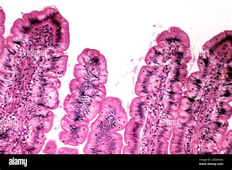 Intestinal Villi Light Micrograph Of A Longitudinal Section Through