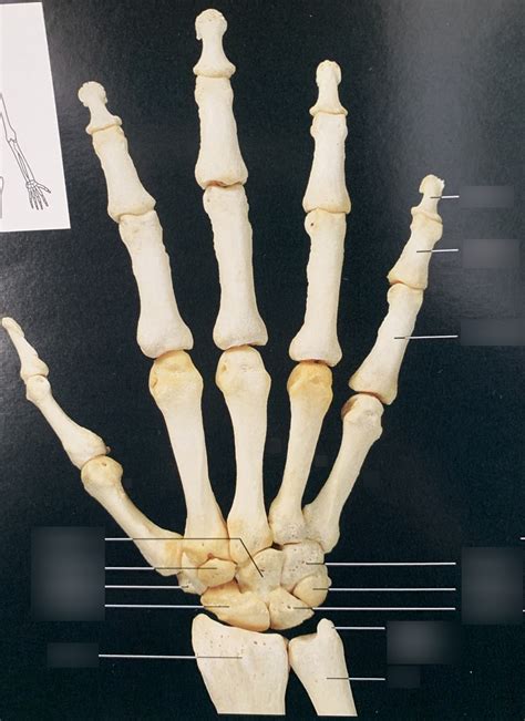 Biol 231 Carpals Metacarpals Phalanges Anatomy Diagram Quizlet