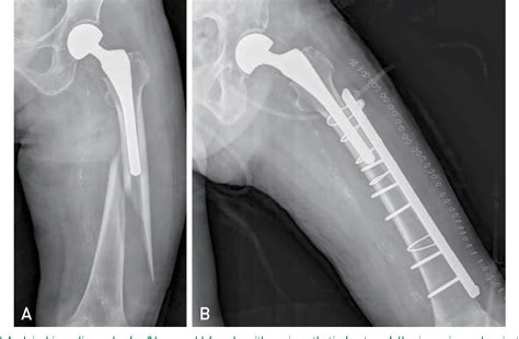 Figure From Could Patient Undergwent Surgical Treatment For