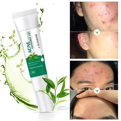 Pickel Narbe Akne Mark Flecken Entfernung Behandlung Gel Salbe Blemish