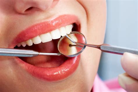 Infección dental Lo que debes saber Clínica Dental Sevilla