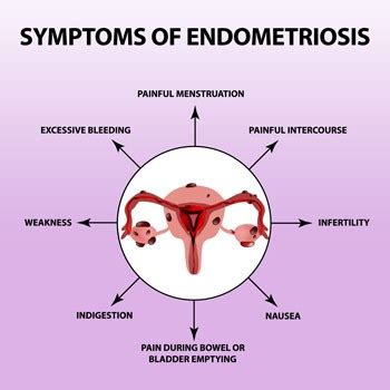 Laparoscopic Endometriosis Surgery Best Gynecological L