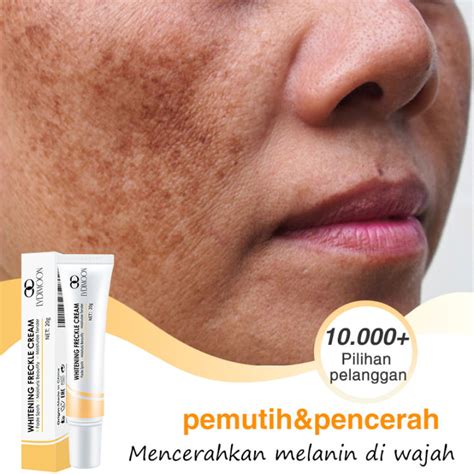 PENGHILANG FLEK HITAM 30ml ANTI FRECKLE CREAM Lazada Indonesia