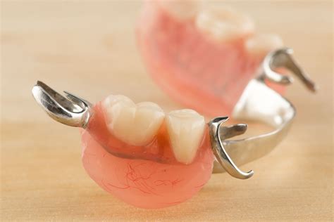 Prótesis dental removible Ventajas y desventajas Dental Cerro Alonso