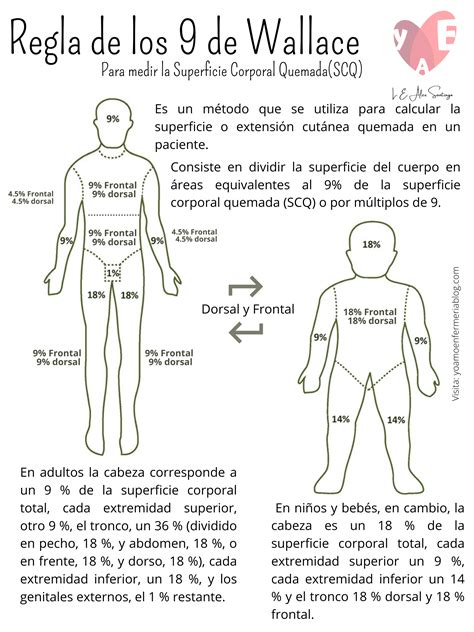 Regla de Wallace pacientes quemados Cuidados de enfermería Tecnico