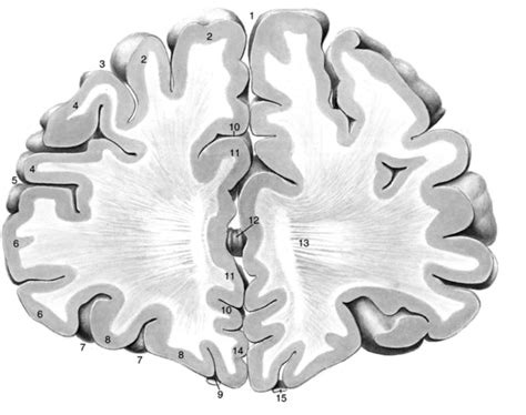 Internal Morphology Coronal Slice Diagram Quizlet