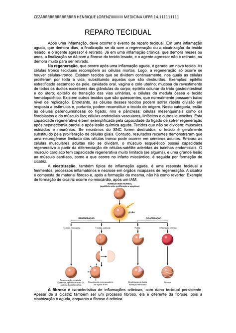 Reparo Tecidual Resumo Patologia Geral REPARO TECIDUAL Após uma